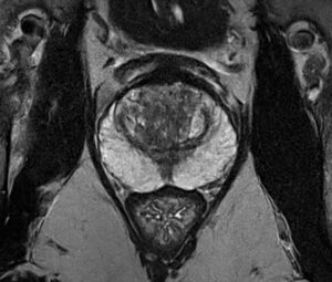MRT der Prostata - MRprax – MRT & Ultraschall