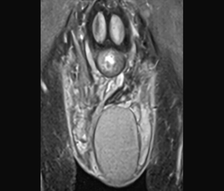 MRT Hoden - MRprax – MRT & Ultraschall