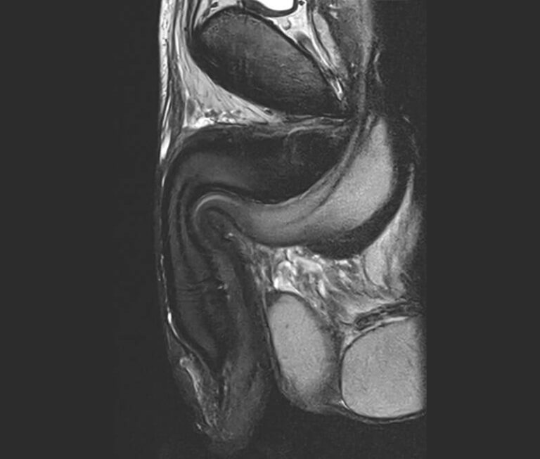 MRT Penis - MRprax – MRT & Ultraschall